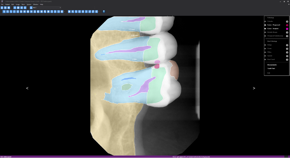 MiPACS + Pearl AI | AI-Powered Dental Radiology Assistant