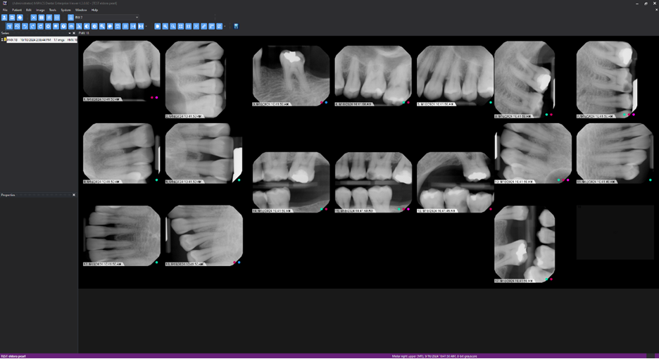 MiPACS + Pearl AI | AI-Powered Dental Radiology Assistant